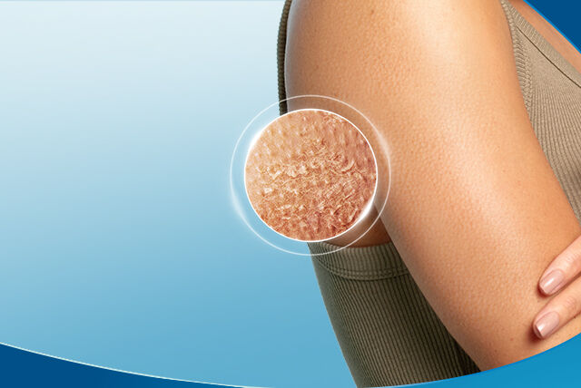 Cetaphil Intensive Healing Lotion for Dry Skin | Cetaphil ZA